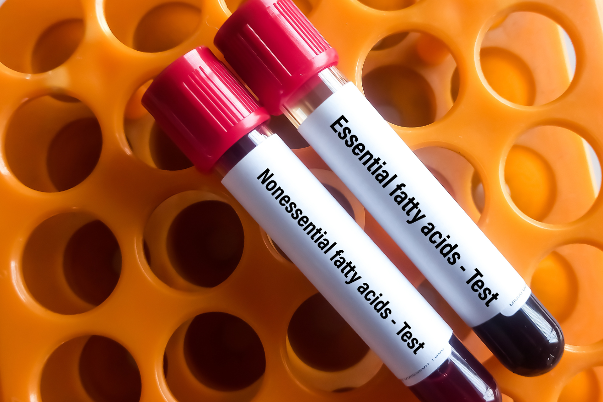 Omega test – badanie stężenia kwasów tłuszczowych - Vigor Point